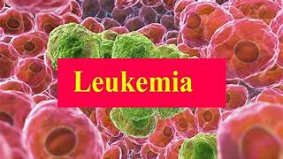 what is Leukaemia – APOMUDEN