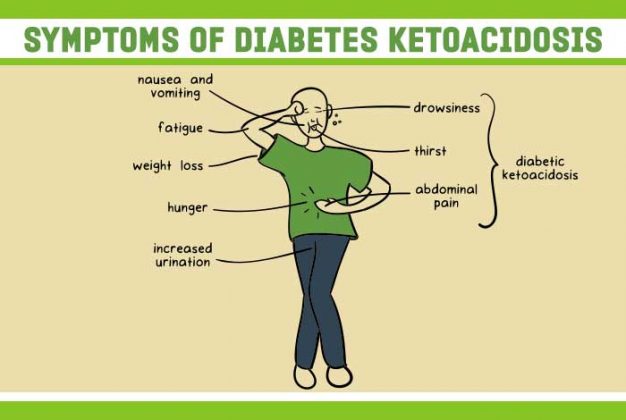 Diabetic Ketoacidosis – APOMUDEN